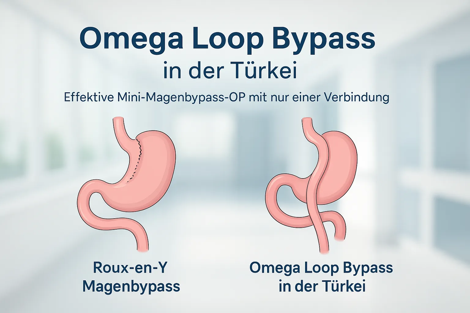 Omega Loop Bypass in der Türkei: 7 Vorteile